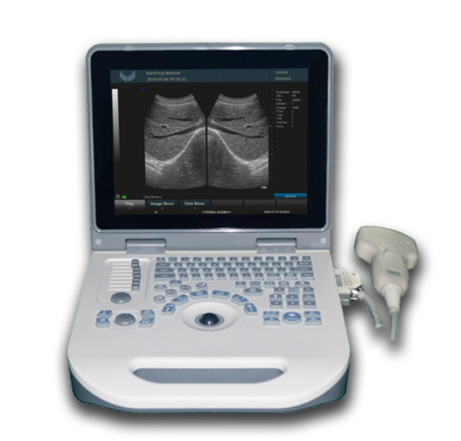 TGC Control Notebook Scanner Laptop Ultrasound Machine For Pregnancy Home