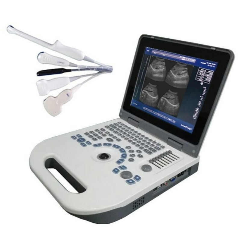ISO Electron Scan Notebook USG Scan Machine For Obstetrics And Gynecology