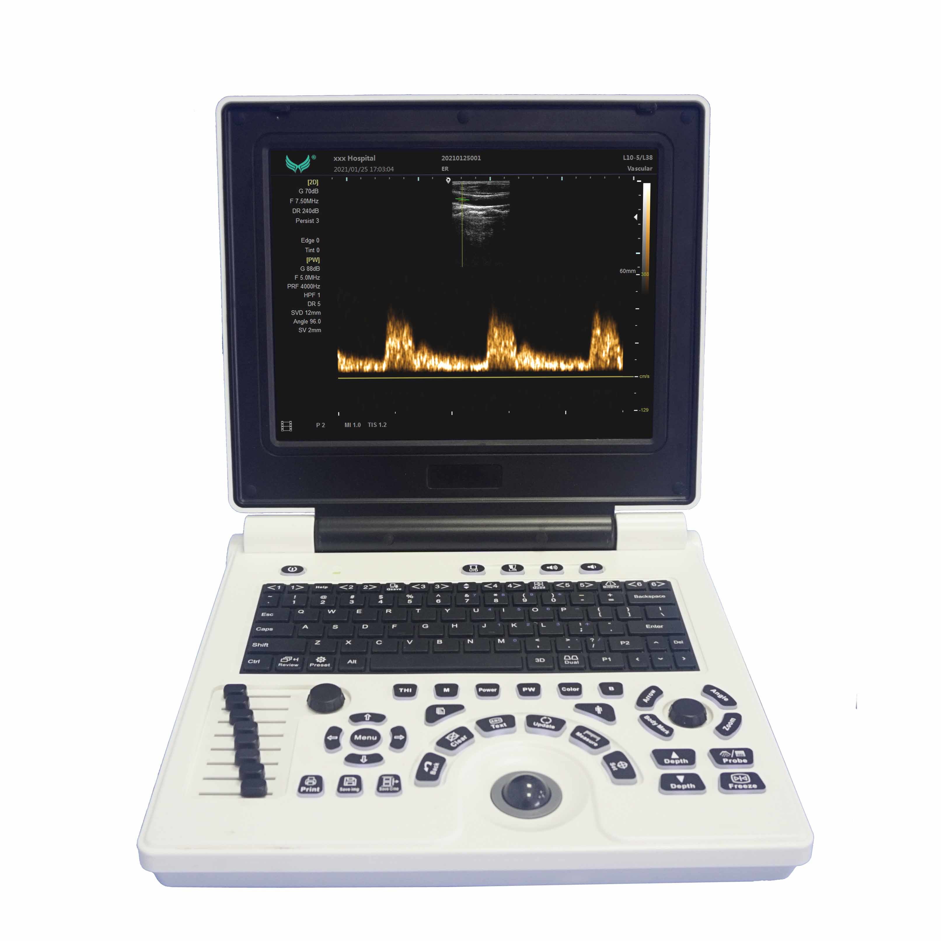 ISO Electron Scan Notebook USG Scan Machine For Obstetrics And Gynecology