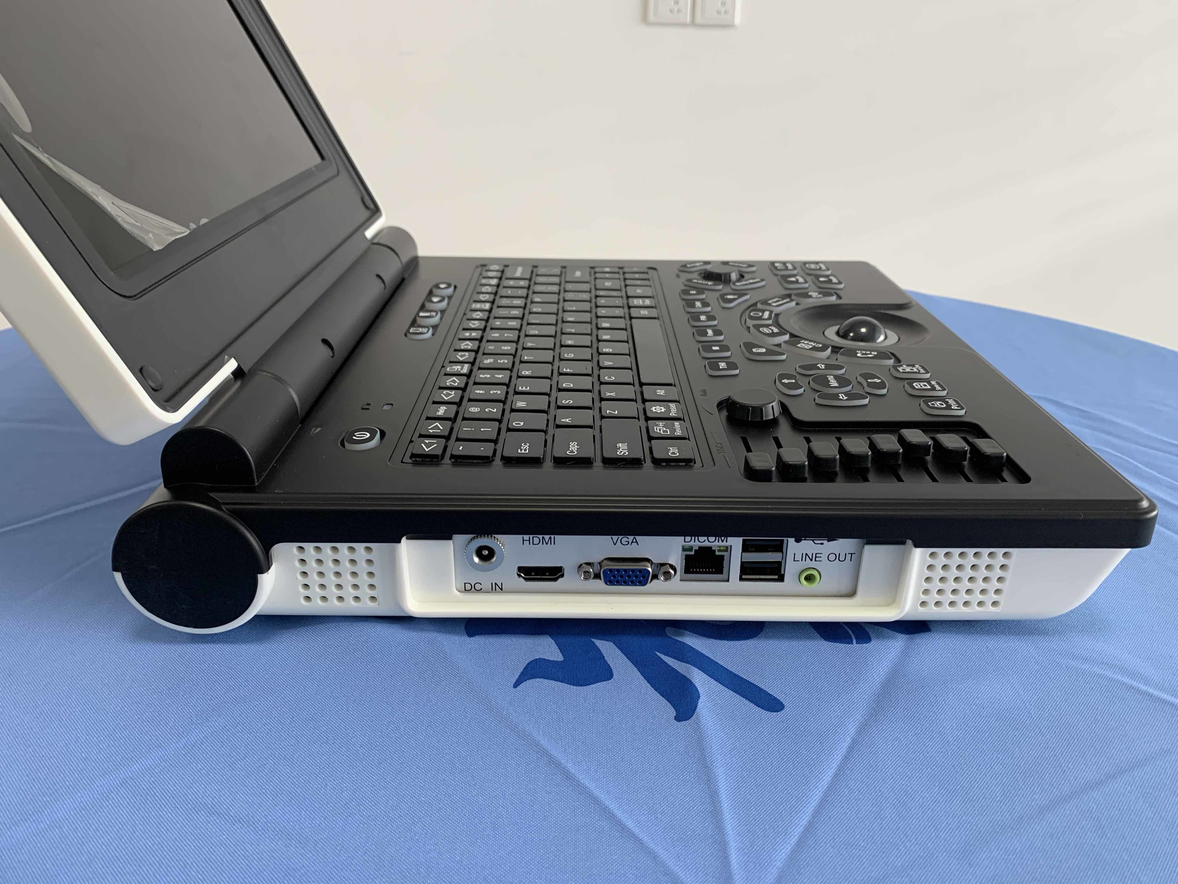 ISO Basic Level Portable USG Machine Digital Color Doppler Ultrasound ...