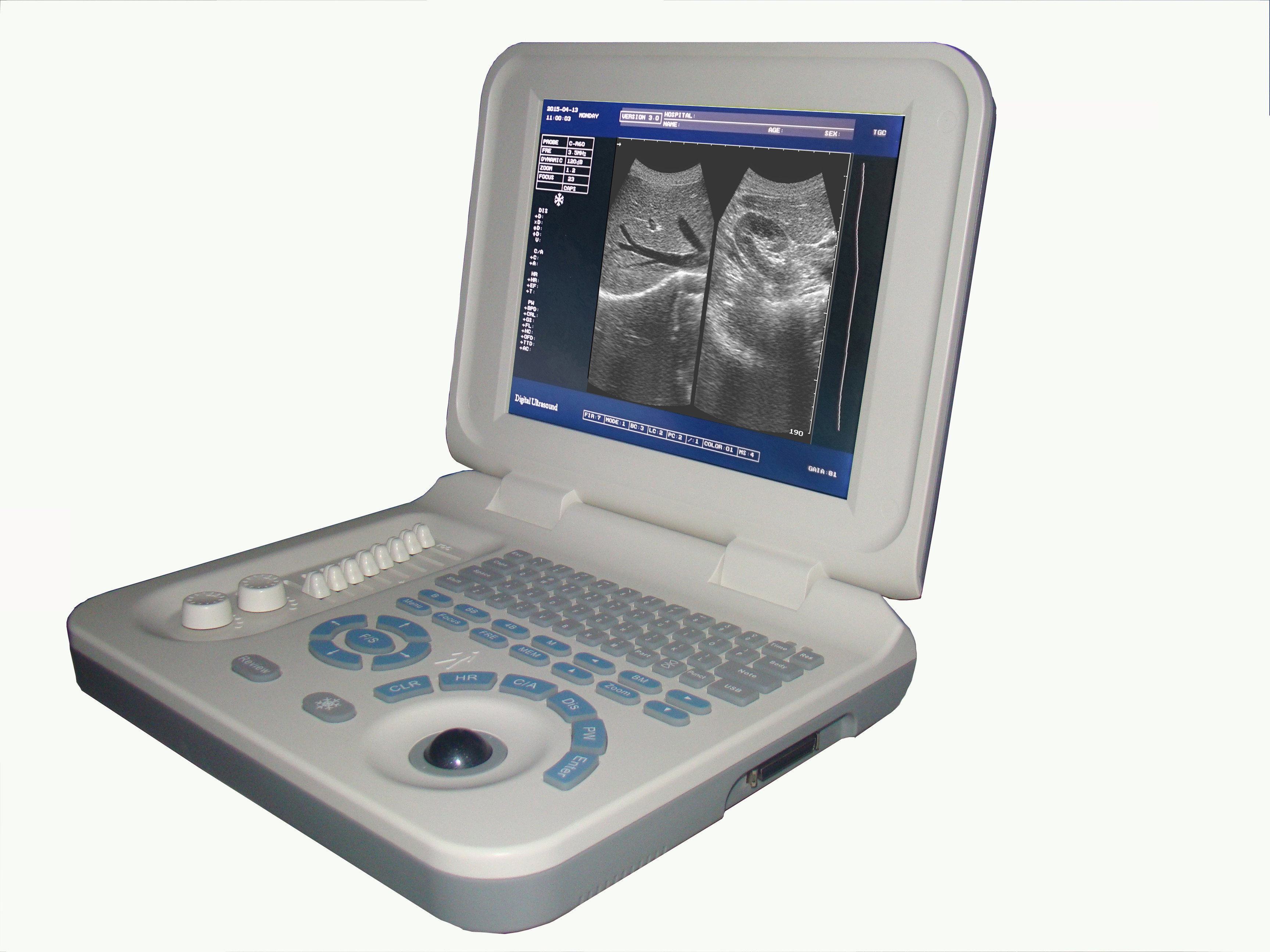 10.4" HD USG Scan Machine Color Doppler Ultrasound Scanner SVGA Output