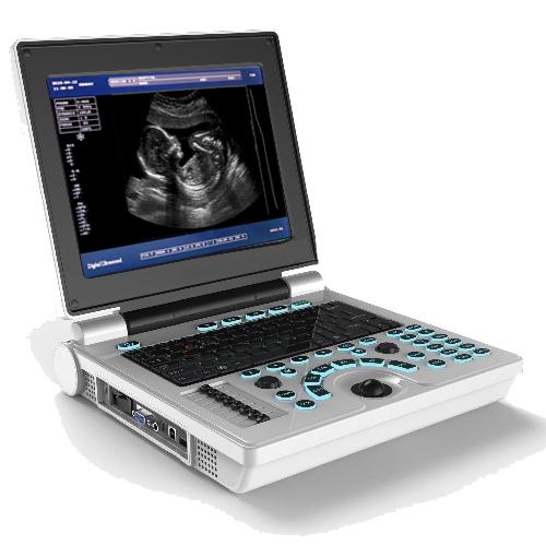 Hospital Laptop Portable USG Machine Portable Ultrasound Machines USS ...