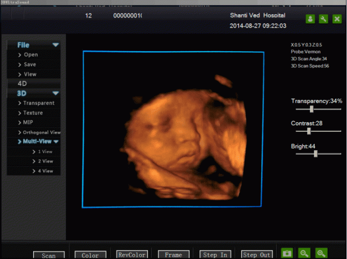 Portable Laptop Color Doppler Ultrasound Machine TGC Control For ...