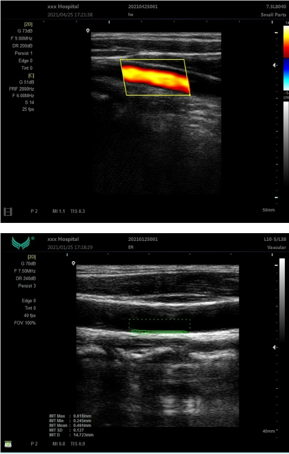 Rechargeable Human Ultrasound Machine For Clinical Hospital VGA HDMI Port