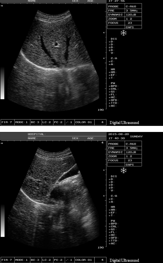 OEM OB Obstetric Ultrasound Equipment LCD Display TGC Control