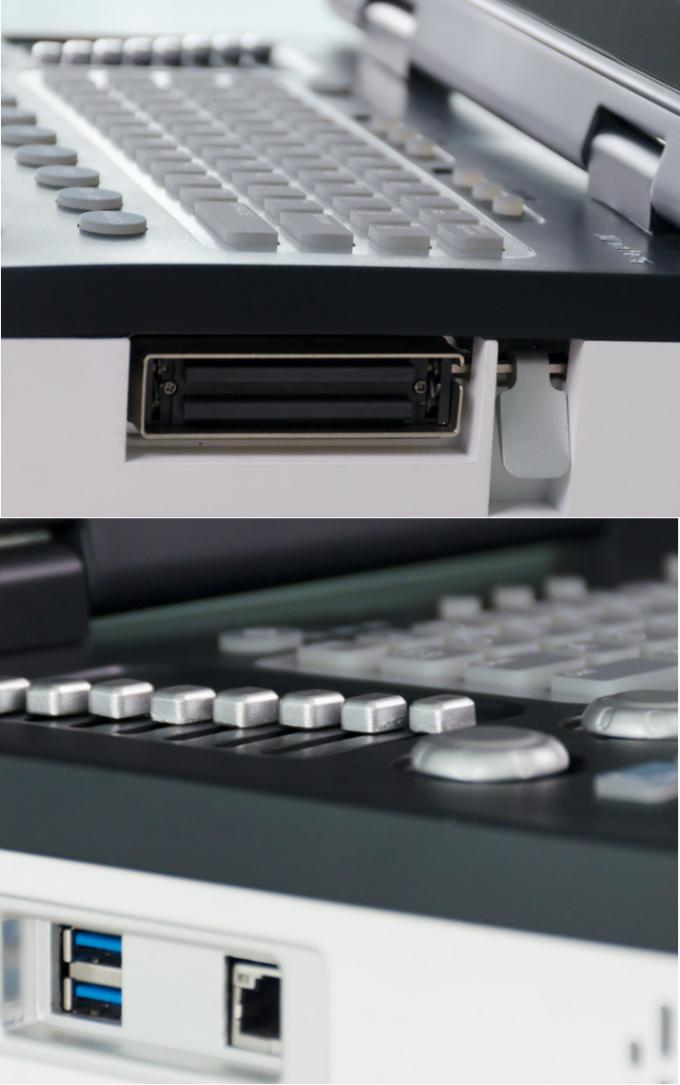 OB Portable Ultrasound Machine Durable 220V For Hospital Clinic